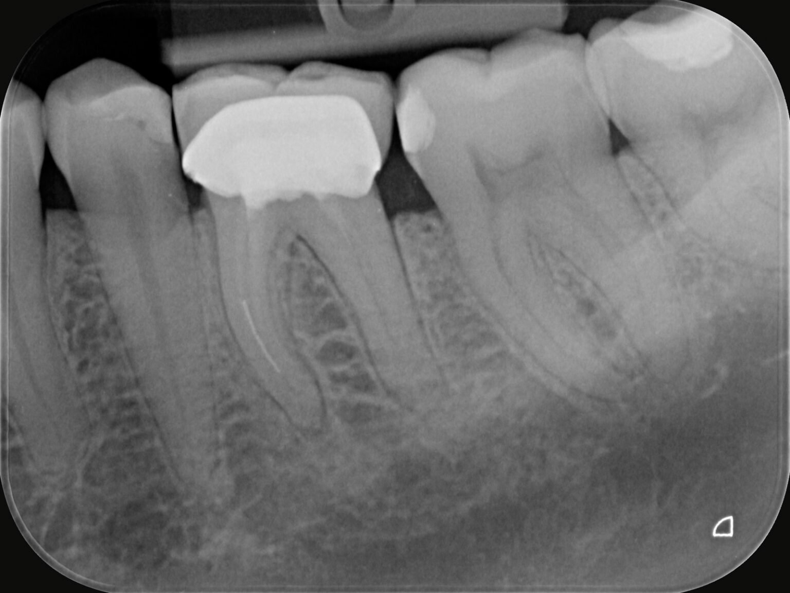 Broken file - ashteaddental.co.uk